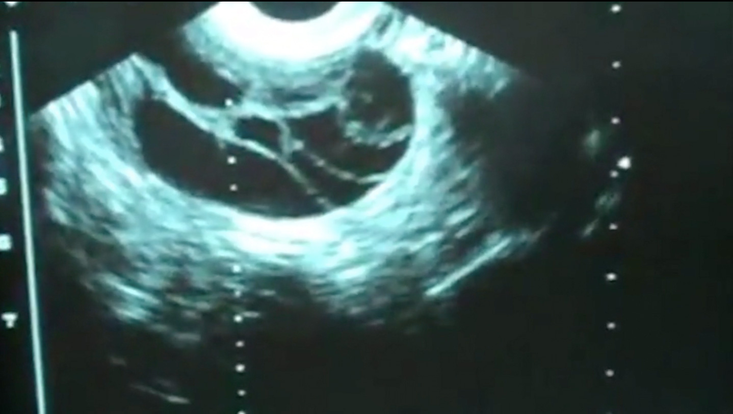 TJ Cuthand - Media City Film FestivalMedia City Film Festival